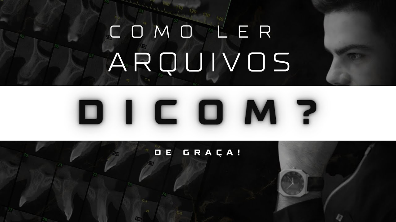 Como Ler Arquivos Dicom Tomografia Gratuito Youtube