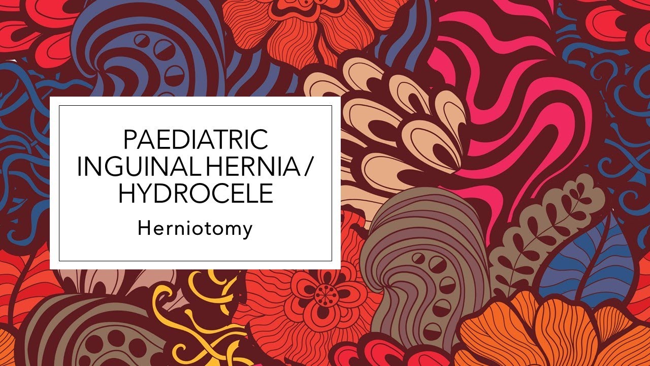 Paediatric Inguinal hernia / Hydrocele - YouTube