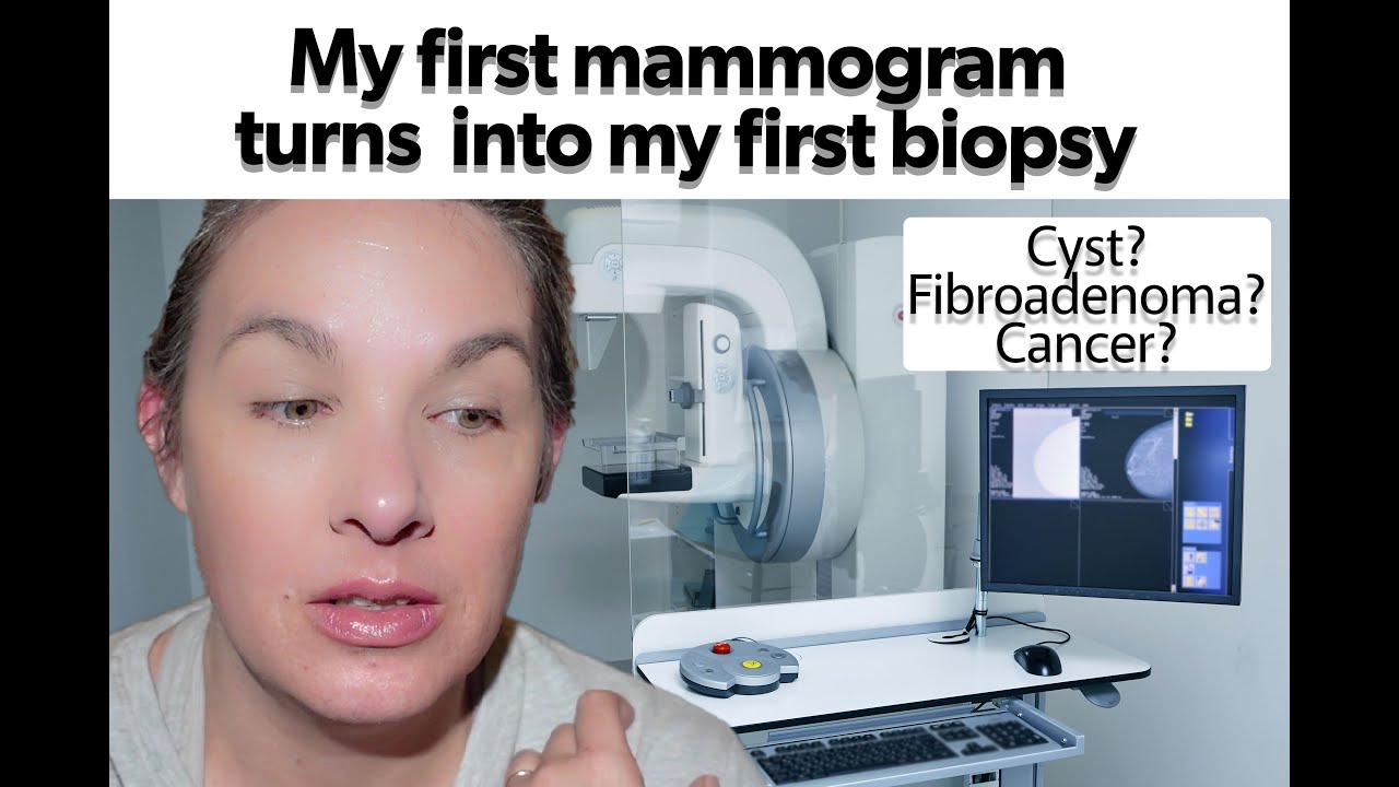 Mt First Mammogram Turns into My First Biopsy. With Results - YouTube