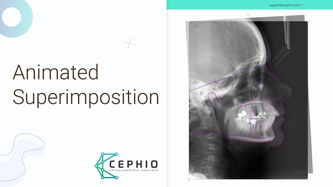 Animated Superimposition - YouTube