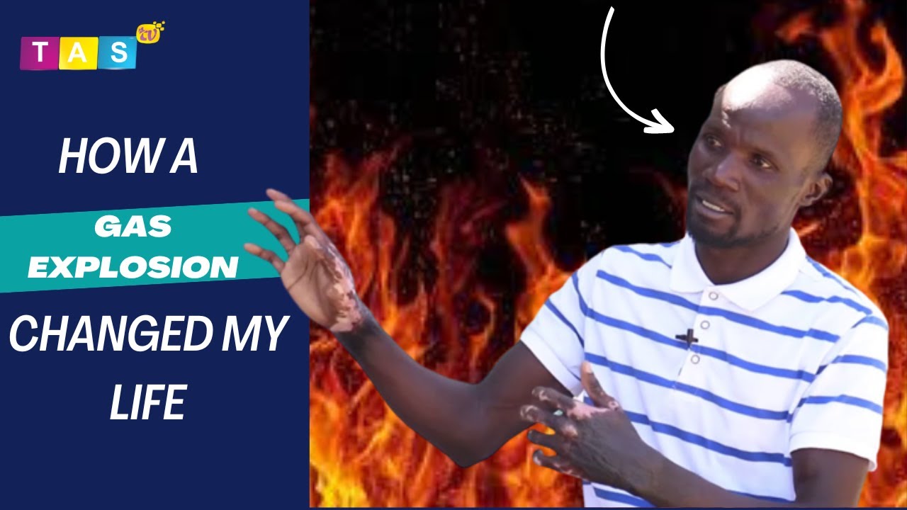 How a gas explosion changed my life forever. - YouTube