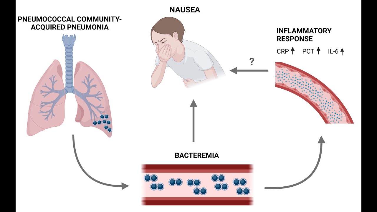 Bacteremia (Presence of Bacteria in Blood) ; Definition, Causes ...