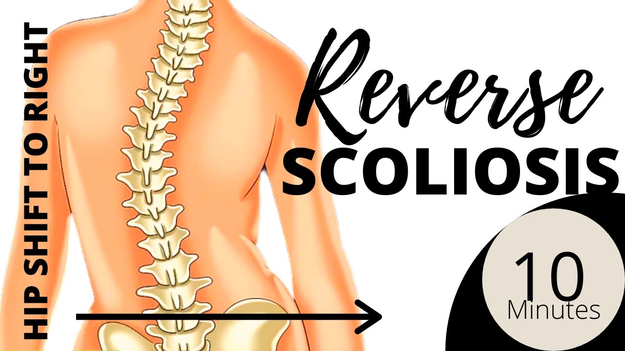 Reverse Scoliosis (RIGHT Hip Shift) Stretch and Strengthen - with ...