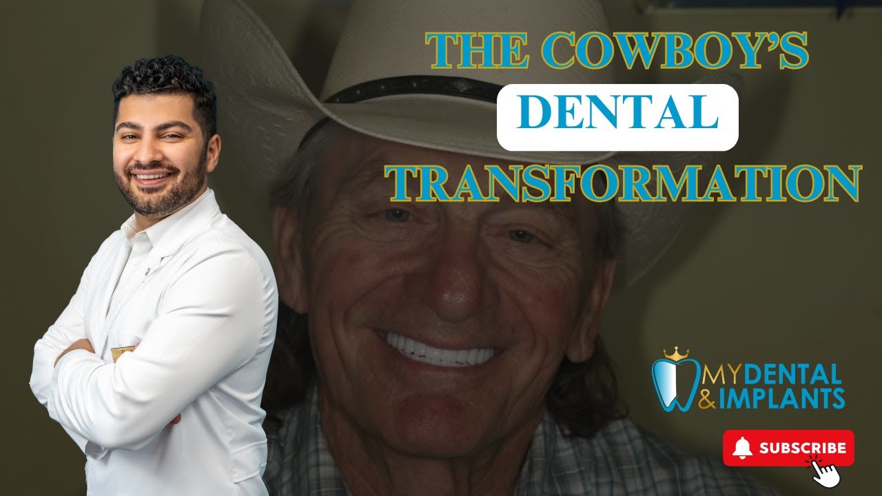 The Cowboy's Dental Transformation. Dennis' incredible dental implant ...