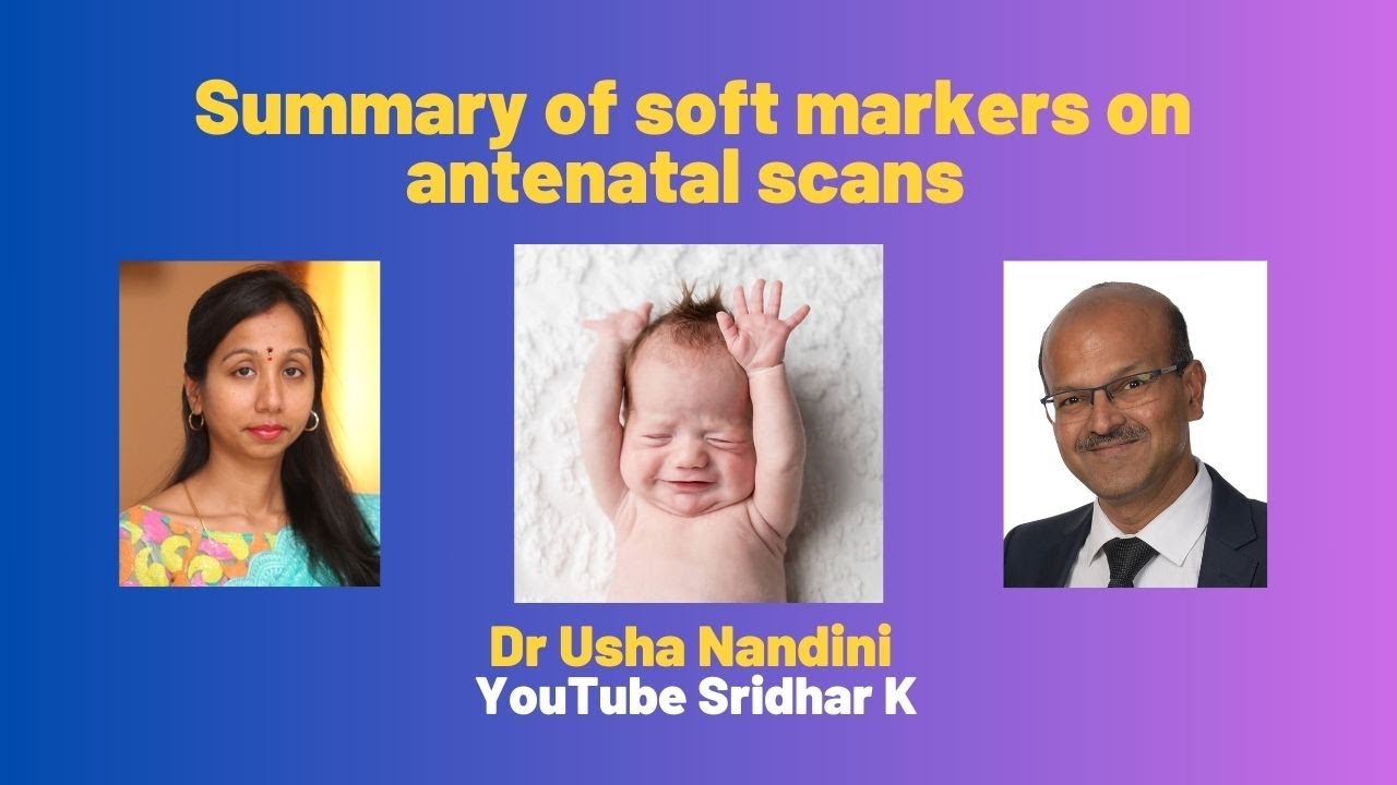 Summary of soft markers on antenatal scans #screening #pregnancy # ...