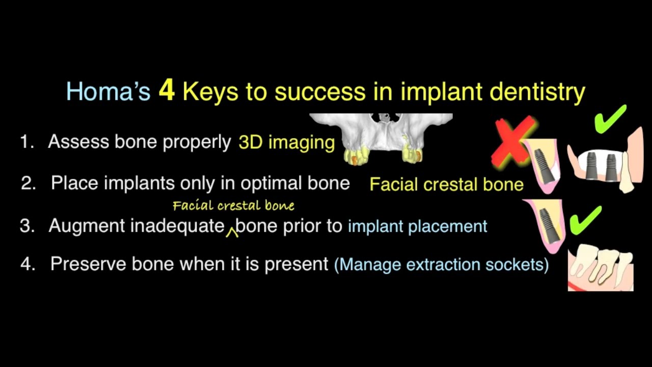 Socket Classification - YouTube