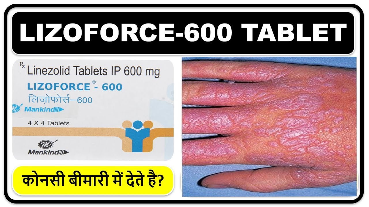 Linezolid (600mg) Uses | Lizoforce Tablet | Linid | Linospan | Linzoliv ...