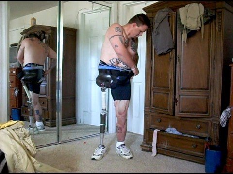 Prosthstic Leg Amputee in underwear getting dressed