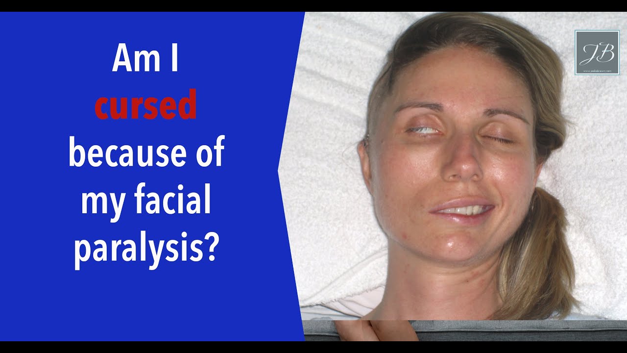 Cursed with facial paralysis? What is advice for mentally dealing with ...