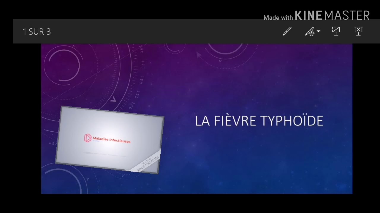 Diagnostic de la fièvre typhoïde - YouTube