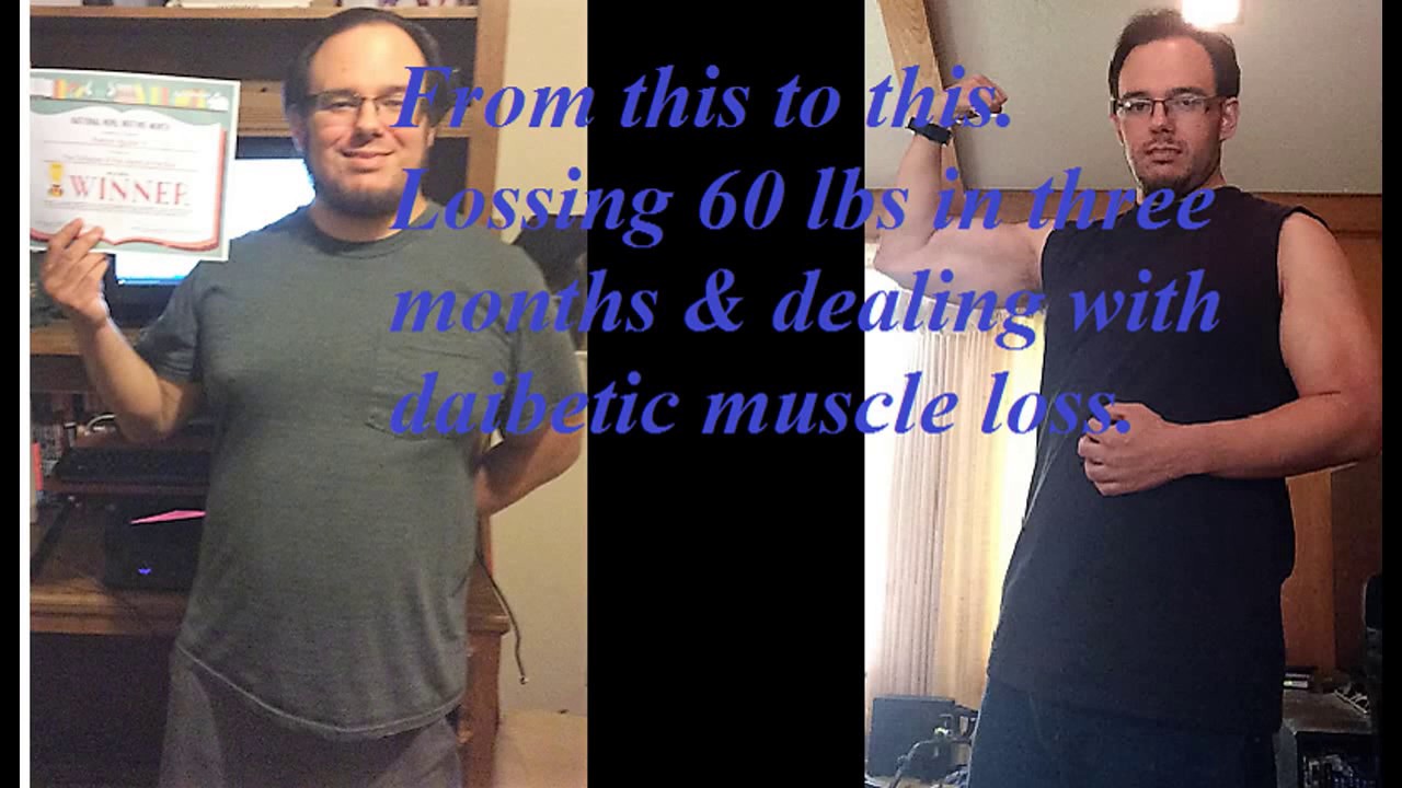 Diabetic Muscle Loss and My Recovery Program - YouTube