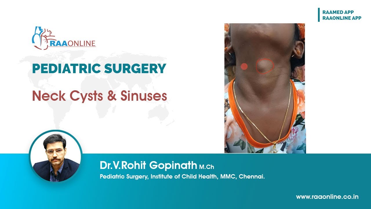 Neck Cysts and Sinuses #NeckCysts #Sinuses - YouTube