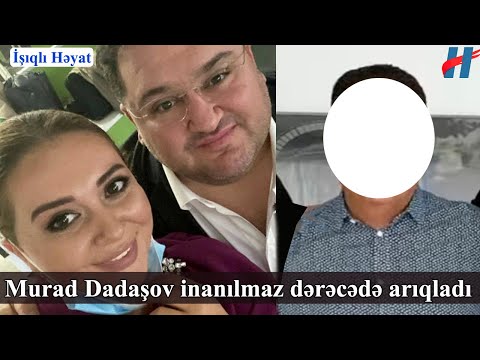 Murad Dadaşov tanınmaz halda - ŞOK FOTO