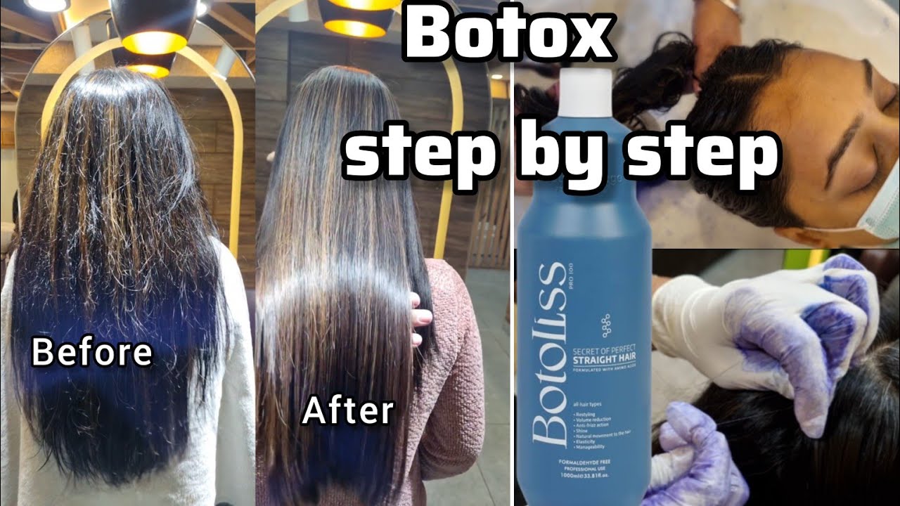 HOW TO : BOTOLISS BOTOX TREATMENT | BOTOX कैसे करते है ? | STEP BY STEP ...