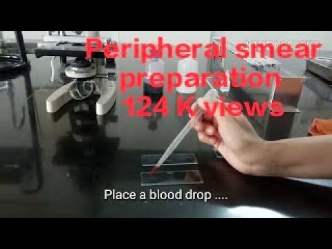 Differential Leucocyte Count (DLC) | practical #mbbs #physiology # ...