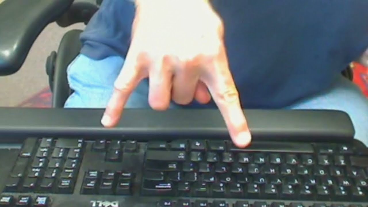 Athetosis Movements Video - Case of Athetoid Patient - Basal Ganglia ...