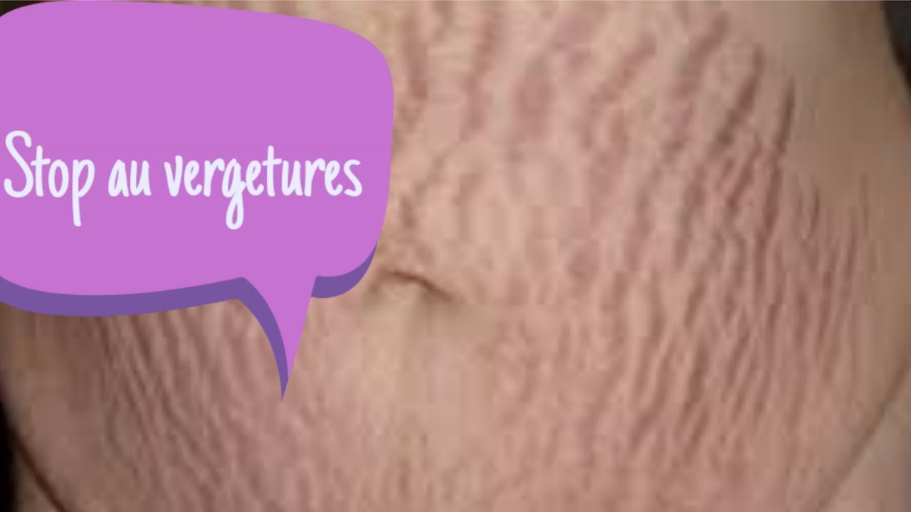 JE VOUS PARLE DE QUELQUES PRODUITS MIRACLES ANTI VERGETURES - YouTube