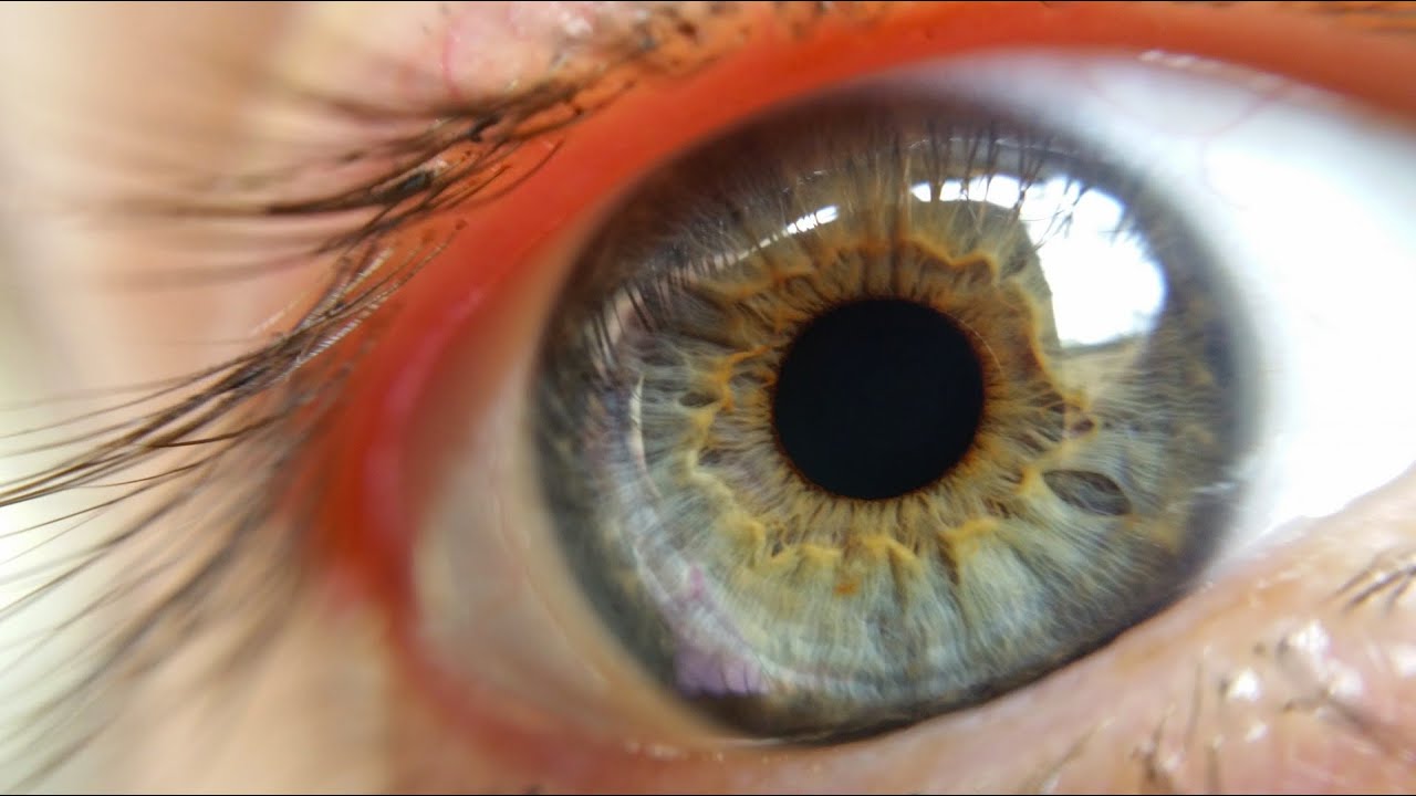 STEM CELL SURGERY Eyeball Breakthrough - UK Surgery Give them a Call ...