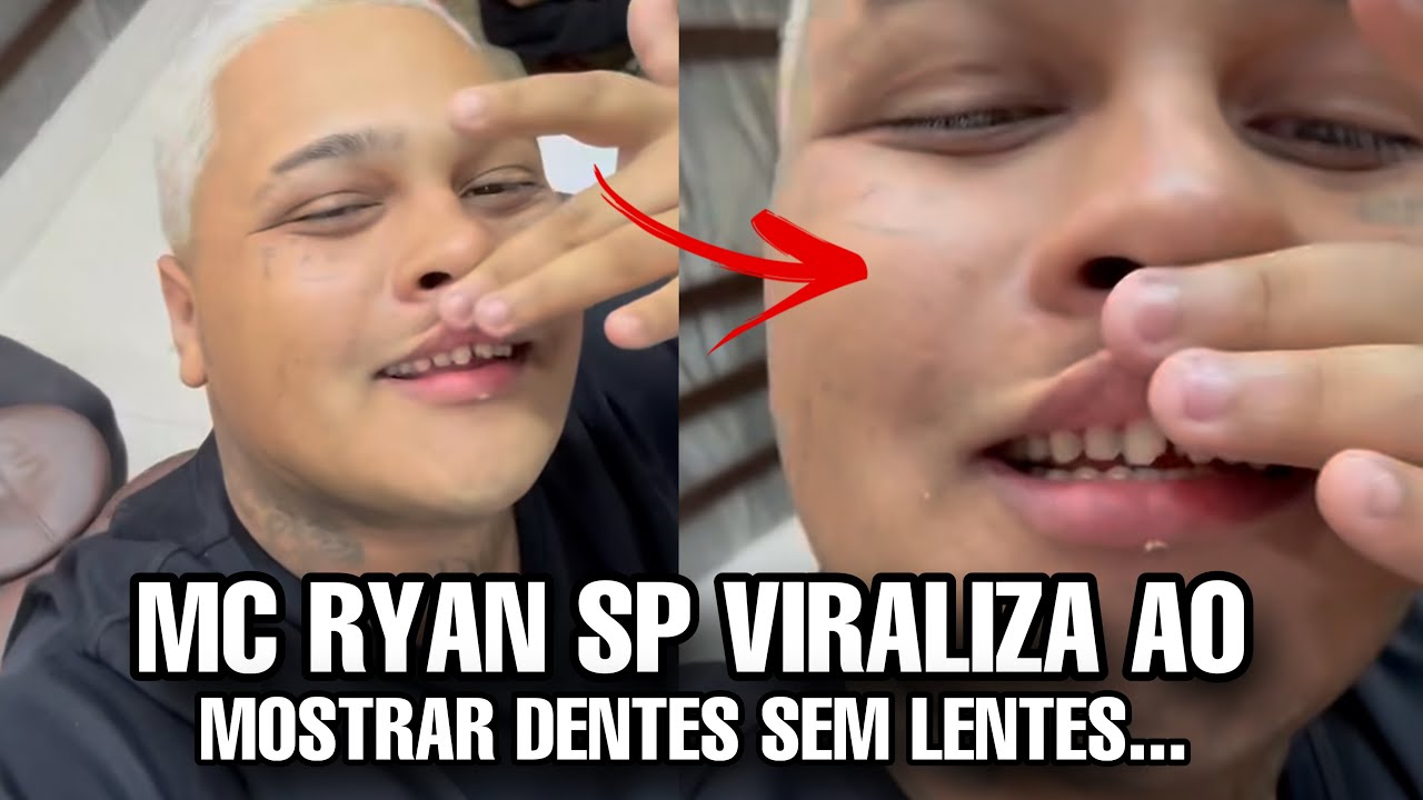 MC RYAN SP viraliza ao mostrar dentes sem LENTES… - YouTube