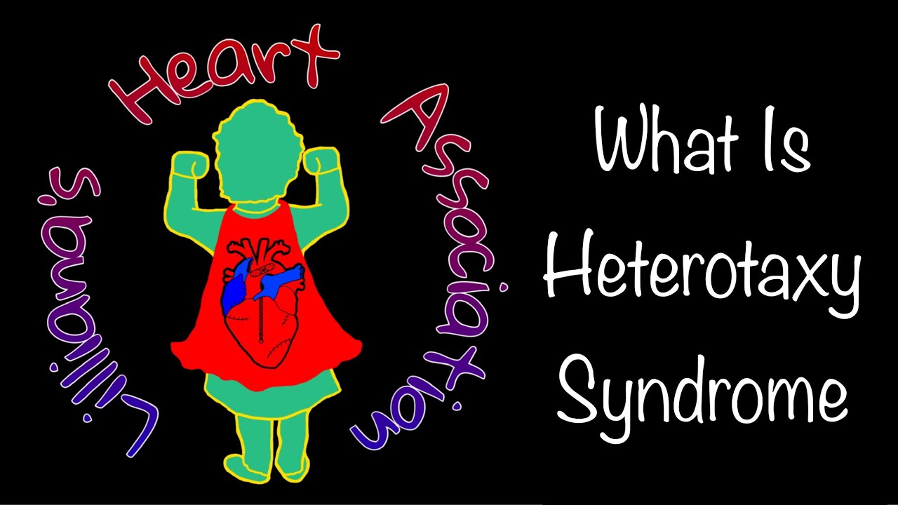 What is Heterotaxy Syndrome? - Lilliana’s Heart Association - YouTube