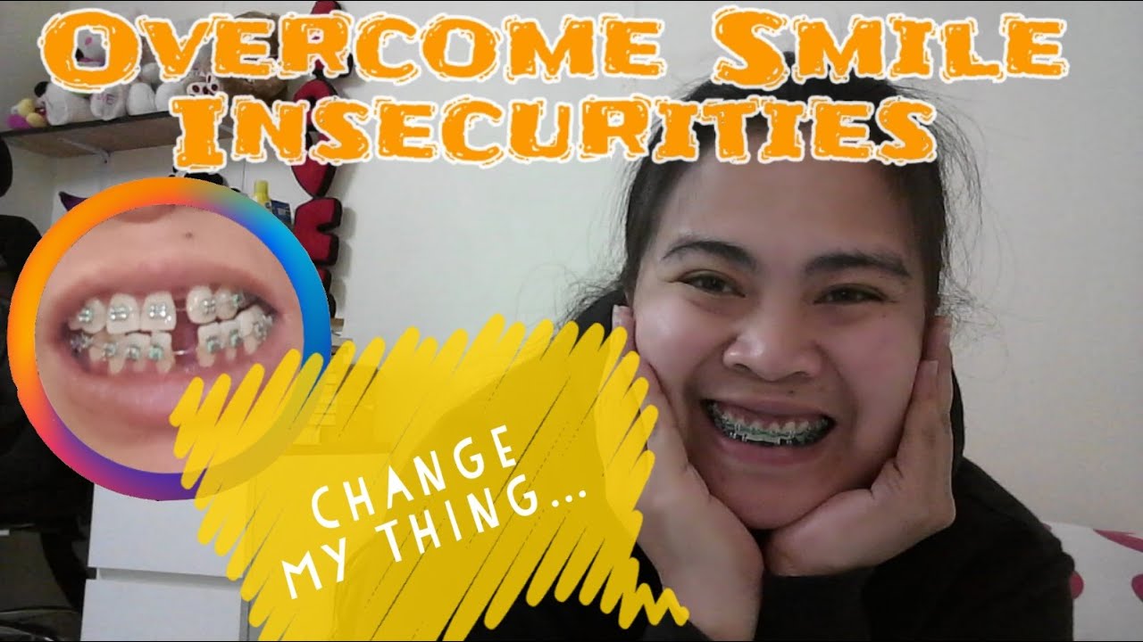 I have a bad teeth/ How I OVERCOME my Insecurity by Auxy Lhai - YouTube