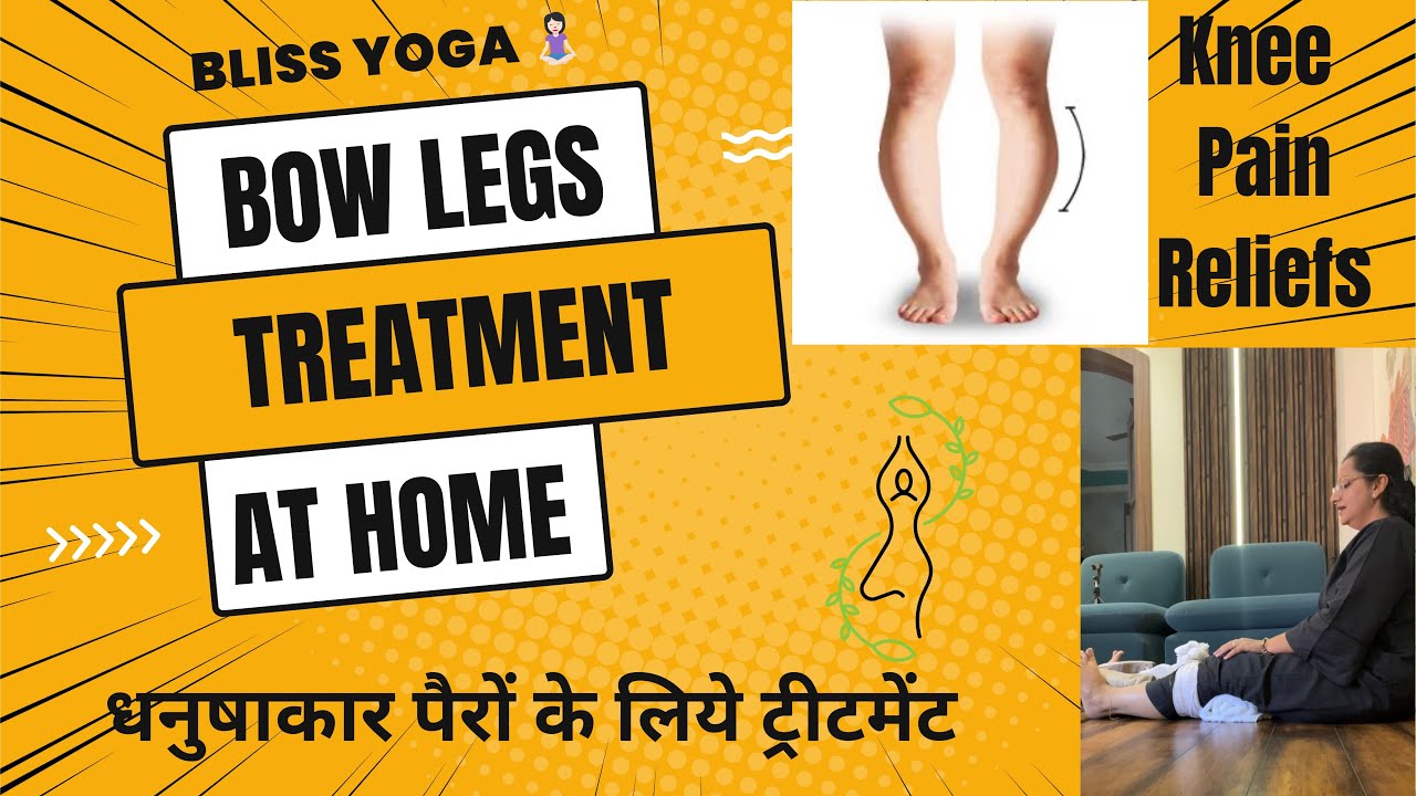 Bow Legs Treatment at Home☺️Knee pain reliefs 🥲 @BlissYoga-16 #Yoga # ...