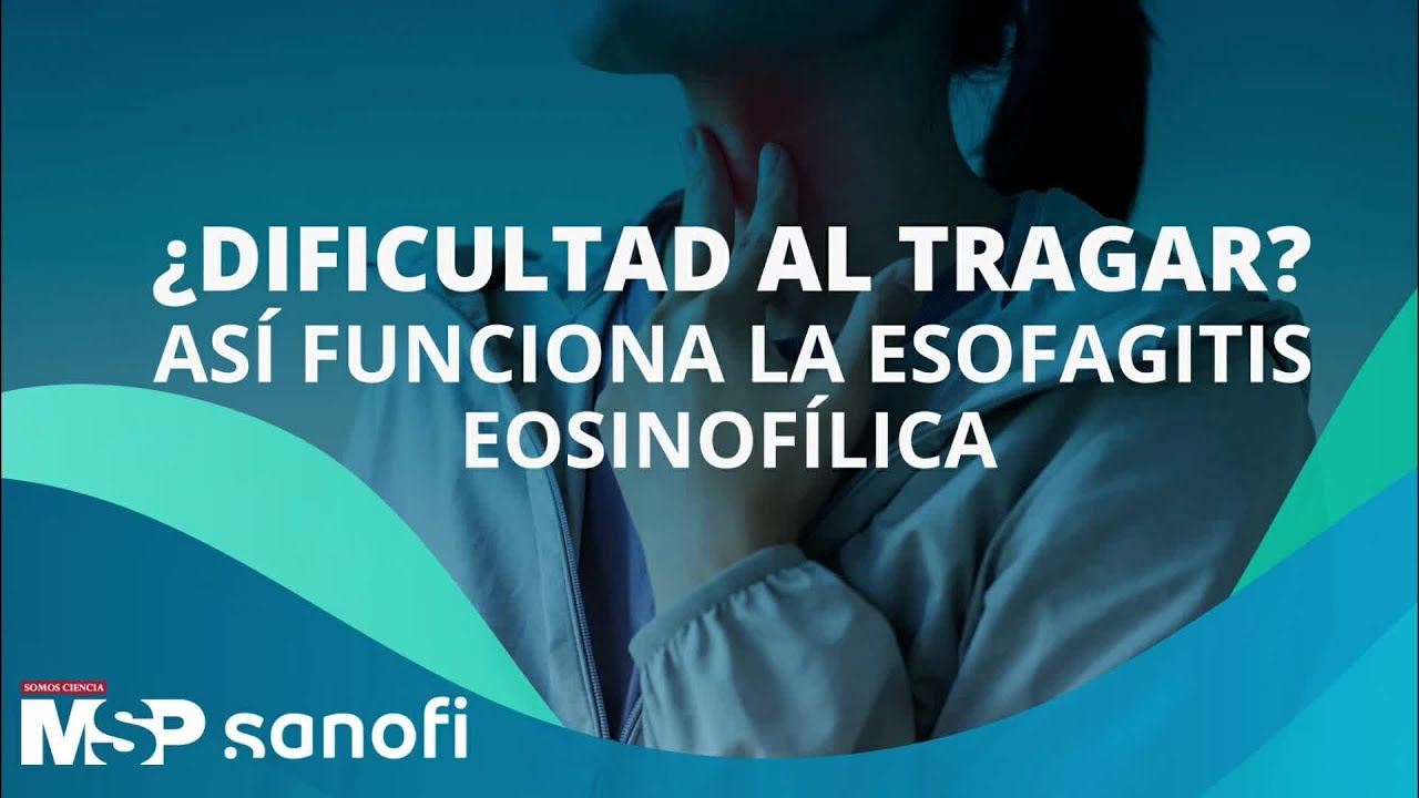 #CápsulaEspecial | ¿Dificultad para tragar? Así funciona la esofagitis ...