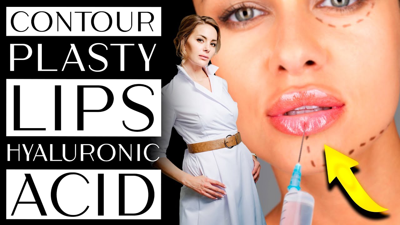 How to enlarge lips VIDEO LESSON, Princess Volume (hyaluronic acid ...