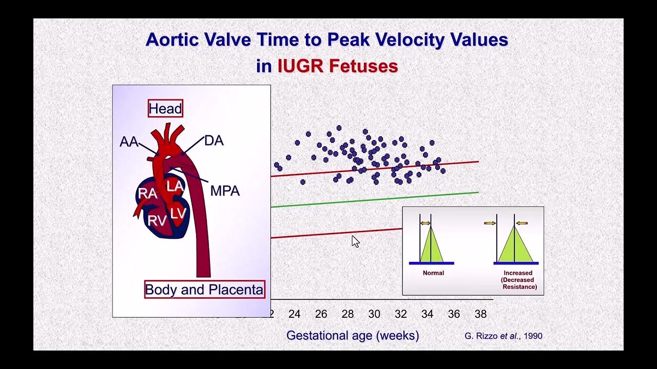Hemodynamics In Iugr Fetuses Youtube