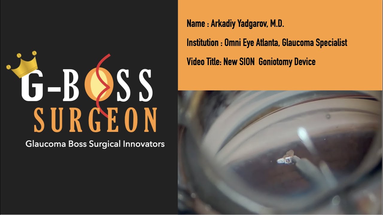 Glaucoma Boss Surgical Innovators Part 10: New SION MIGS Goniotomy ...
