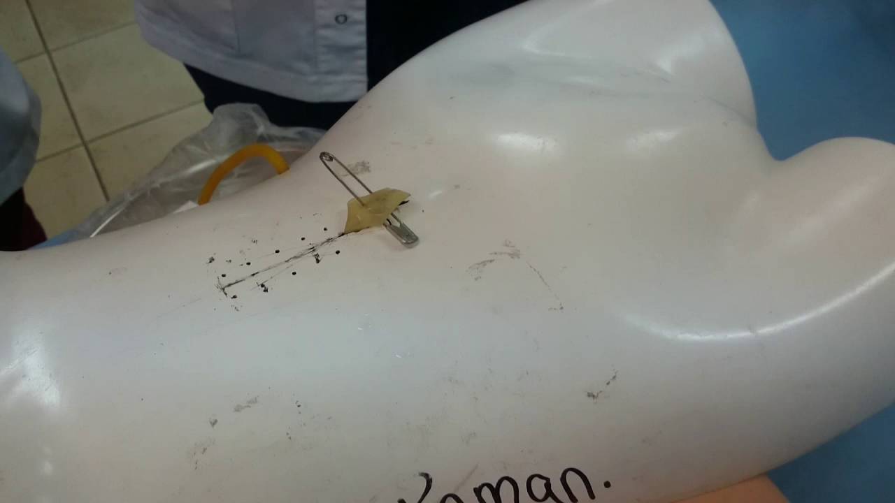 Curacion (limpieza de herida y drenaje) - YouTube