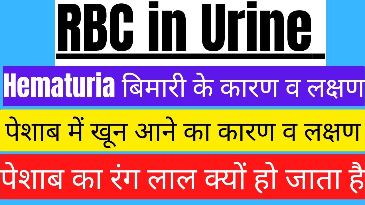 RBC in Urine in Hindi I Microscopic Examination of RBC in Urine I ...
