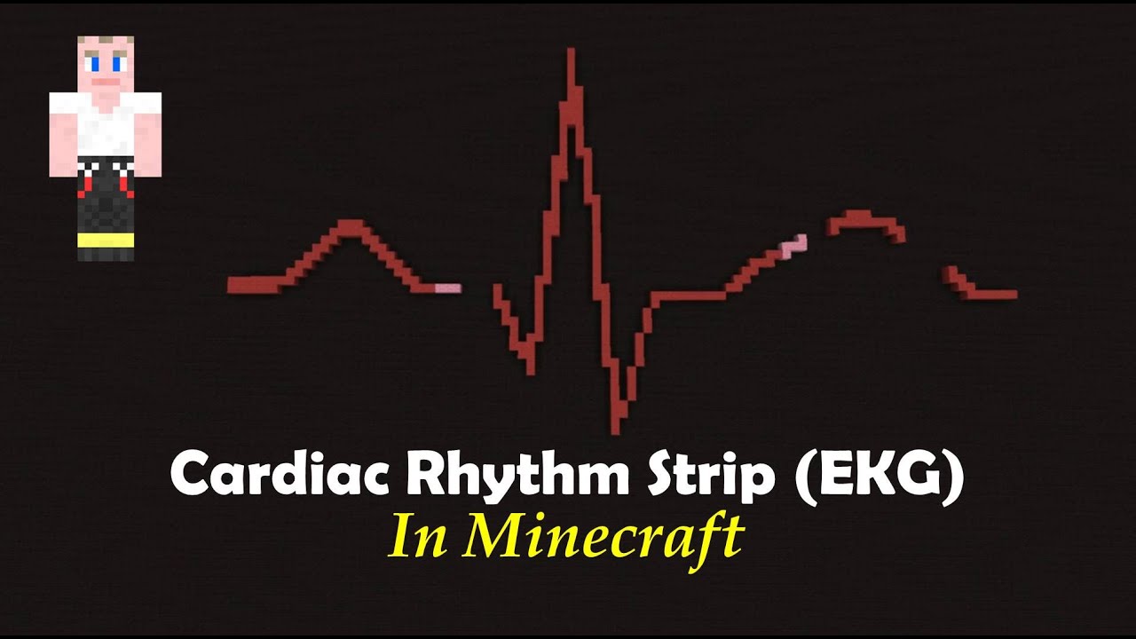 Minecraft - A Cardiac Rhythm Strip (EKG) in Minecraft - YouTube