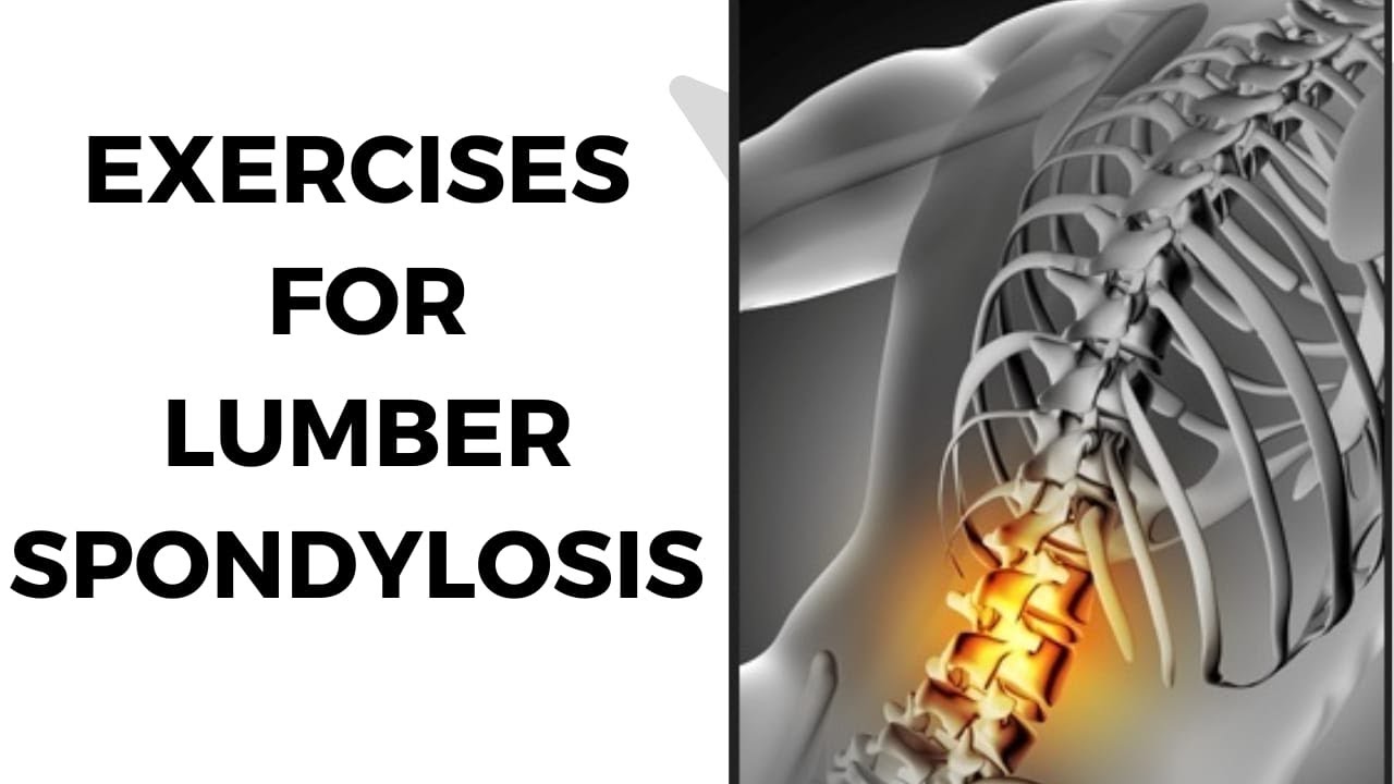 Best exercises to treat lumber spondylosis|exercises for back pain ...