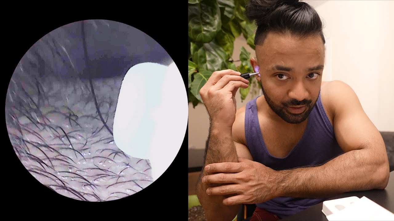 Inside the Human Ear Magnified 1000x - YouTube