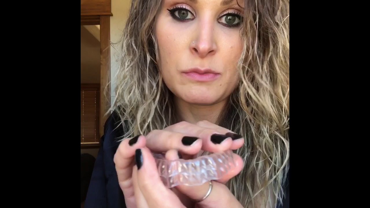 Smile Direct Club, Month 3 week 1 (5 of 14) - YouTube