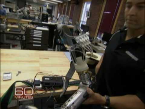 The DEKA Arm - YouTube