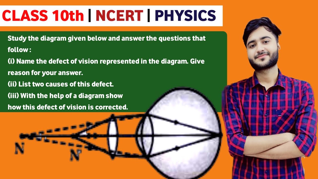 Defect of Eye Vision, Cause of Defect- Class 10th Science - YouTube