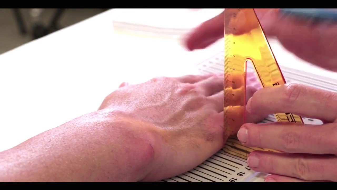 Performing limb circumferences measurements - YouTube