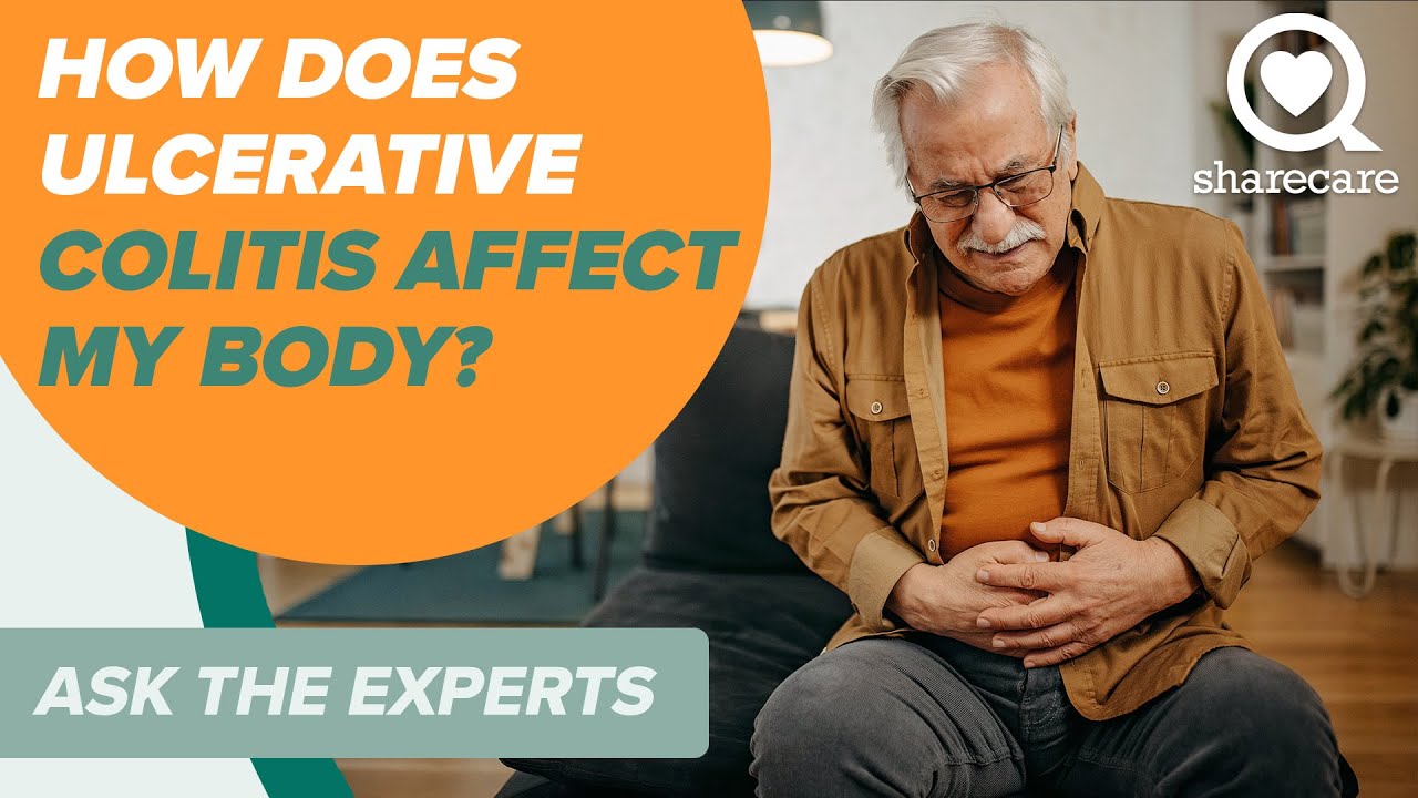 How Does Ulcerative Colitis Affect My Body? | Ask The Experts ...