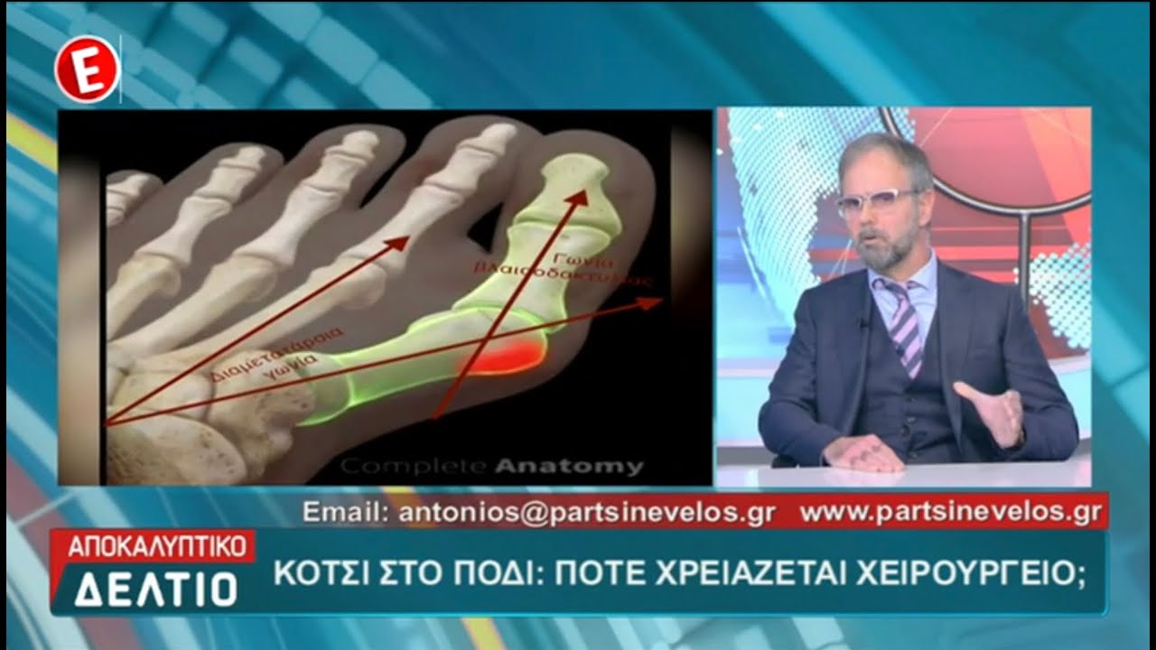 Κότσι στο πόδι; Υπάρχει πρόληψη; Λόγοι που θα μας οδηγήσουν σε ...