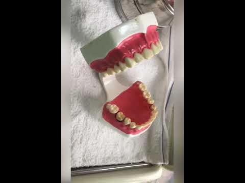 Tutorial Restorasi Klas IV GV.Black Dengan Bahan Resin Komposite - YouTube