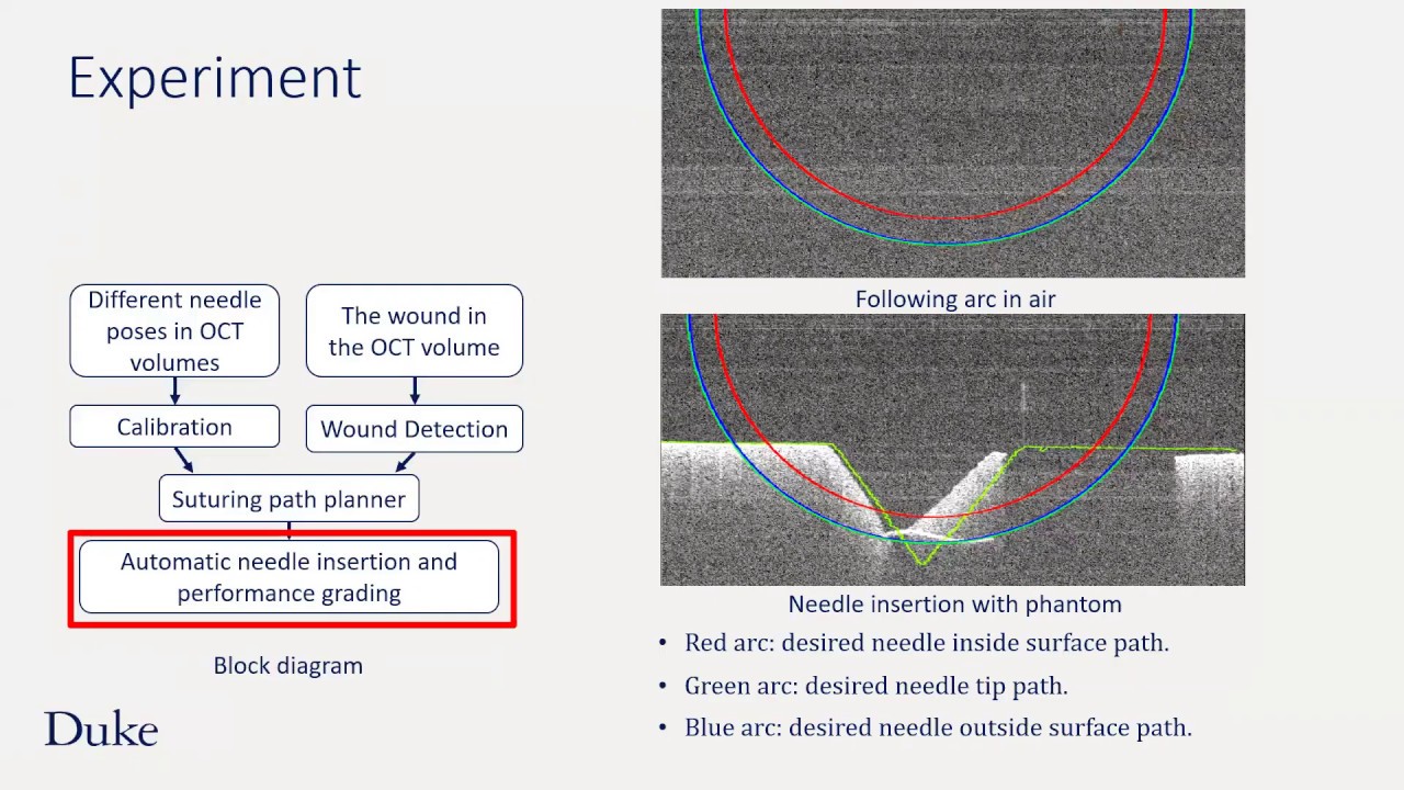 ICRA 2020 summary video: Toward Autonomous Robotic Micro-Suturing - YouTube