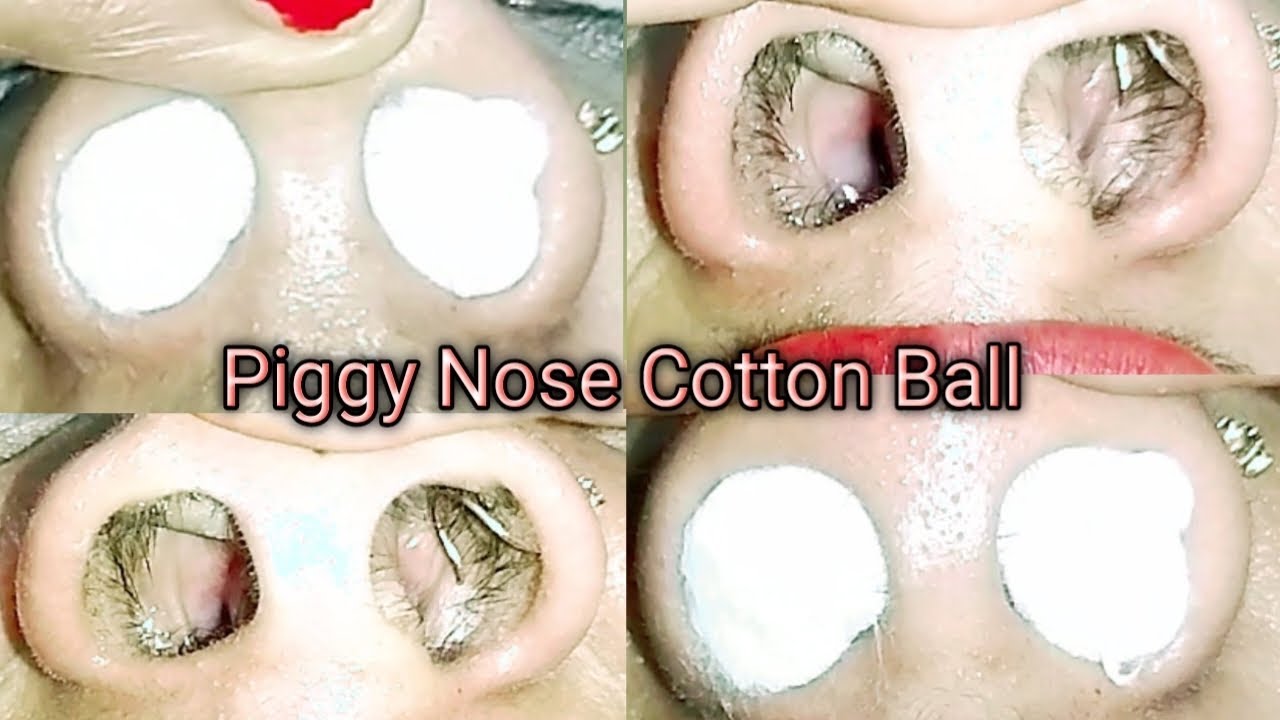 Piggy Nose Cotton Ball || Piggy Nose With Cotton Ball - YouTube