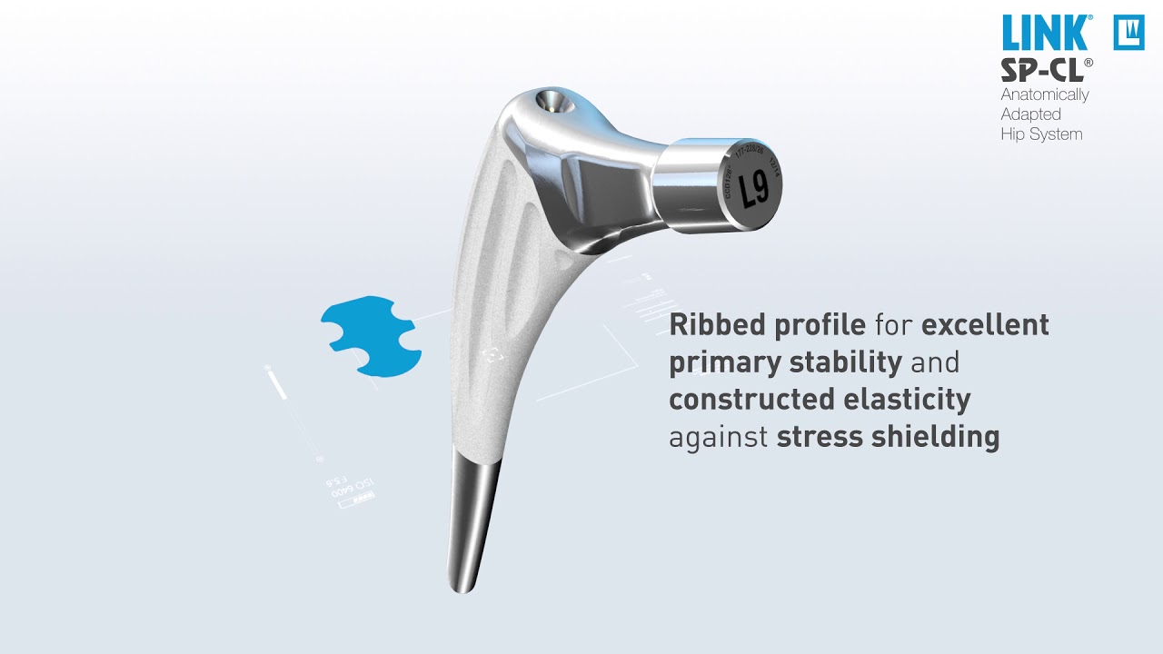 LINK SP-CL - Anatomically Adapted Cementless Hip Prosthesis Stem - YouTube