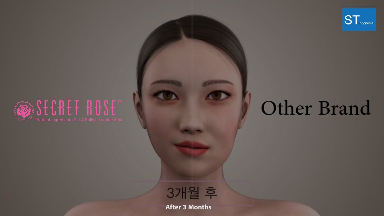 Secret Rose - YouTube