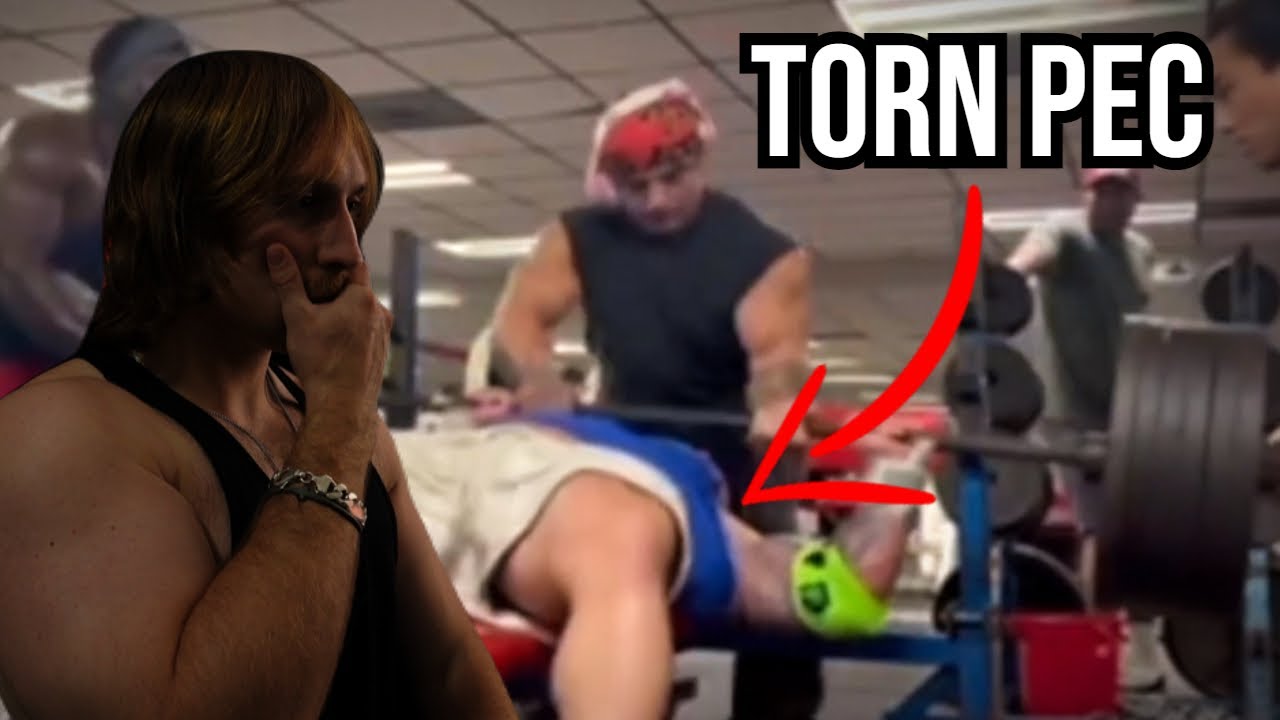 Tren Twins Mike’s Torn Pec | How To Prevent Chest Injuries - YouTube