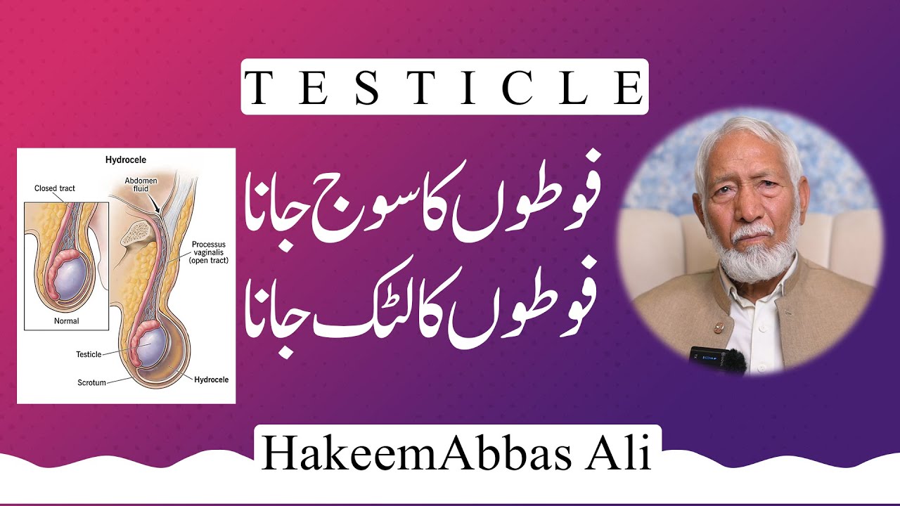 How to treat swollen and painful Testicle TREATMENT BY HAKEEM ABBAS ALI ...