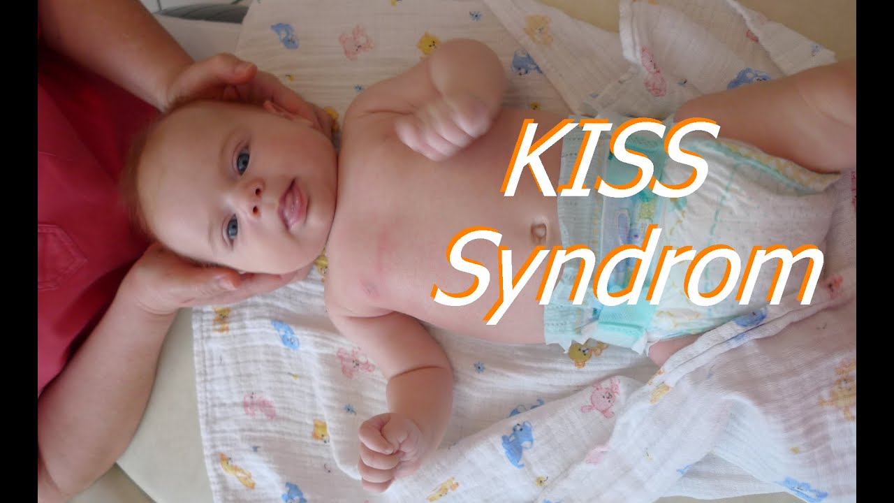 Erworbene KISS Syndrom bei Babys ab 2-3 Monaten nach Geburt. Ursachen ...
