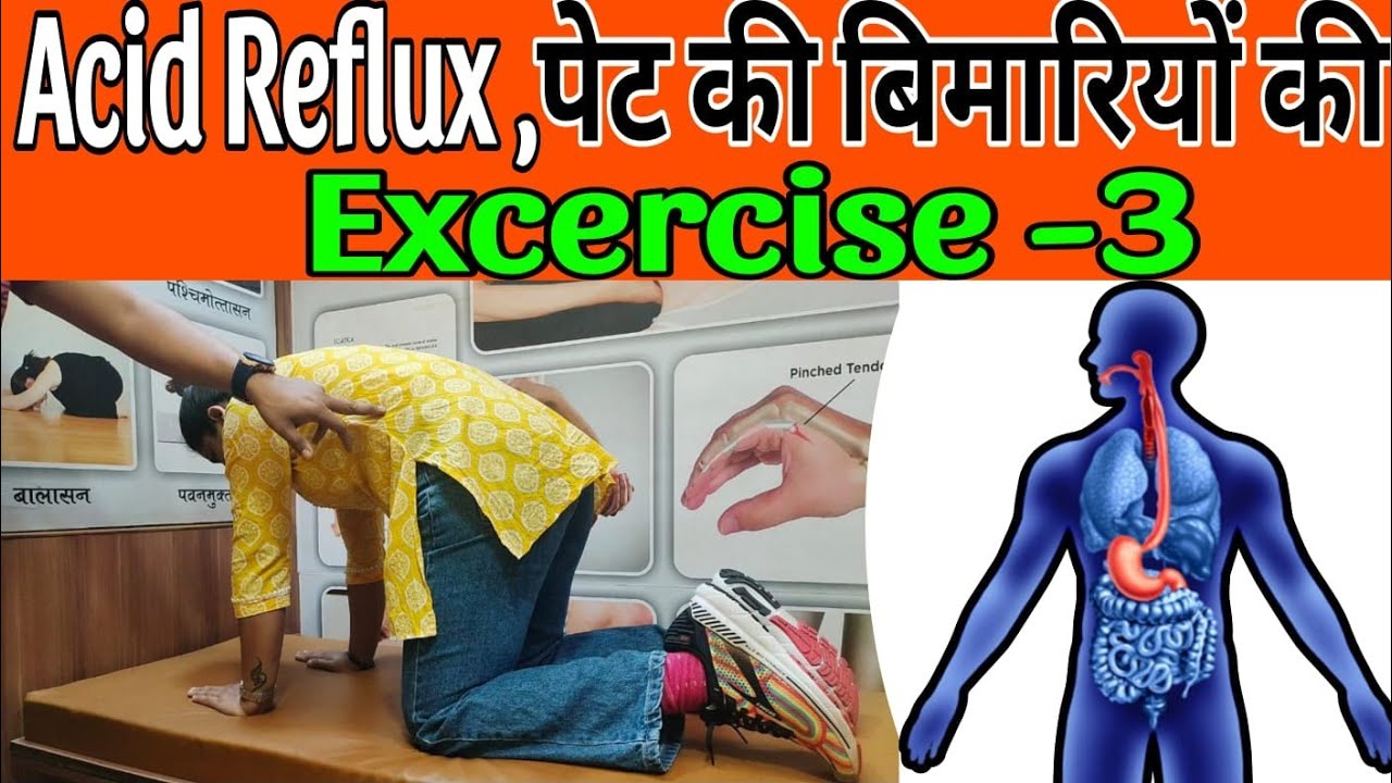 Acid Reflux GERD: Effective Exercise - YouTube